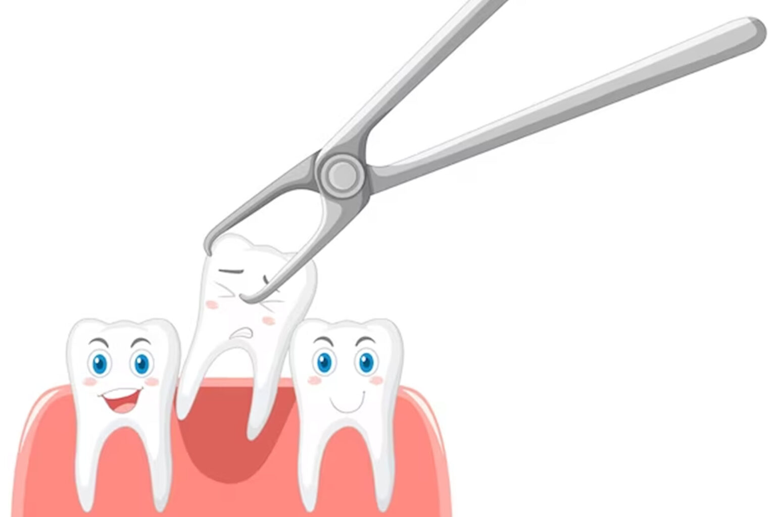 Simple vs. Surgical Tooth Extractions: Which Option is Right for You ...